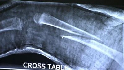 Watch The Real A&E Season 1 Episode 30 - Episode 30 Online Now